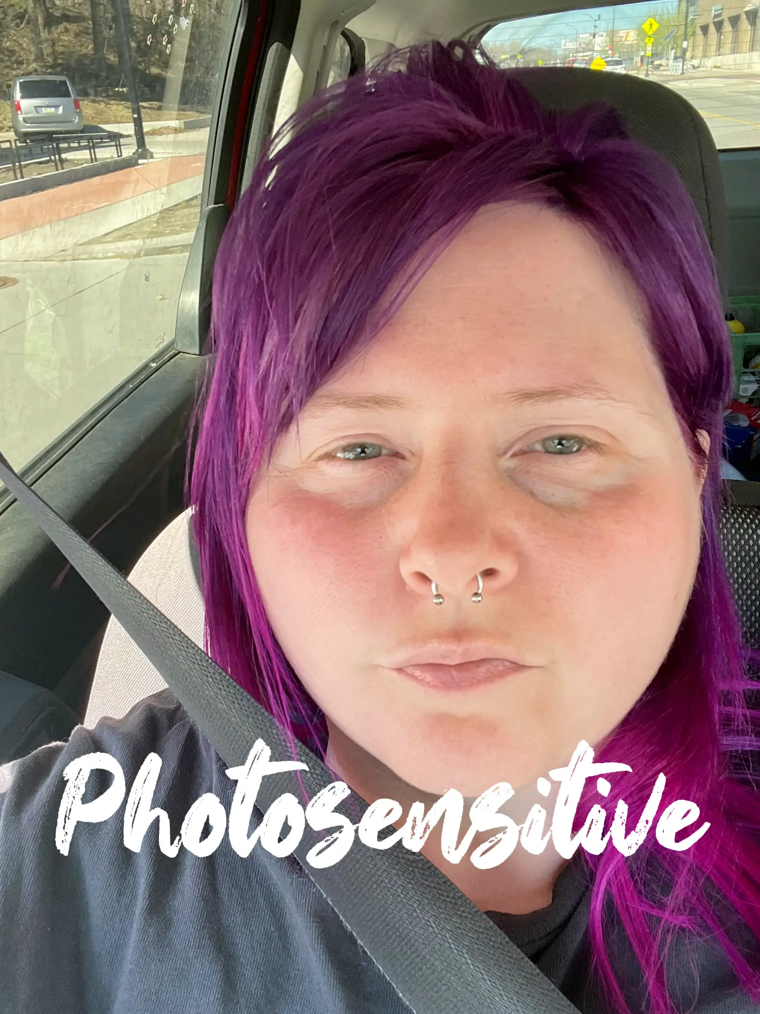 I’m photosensitive | แกลเลอรีที่โพสต์โดย Ami | Lemon8