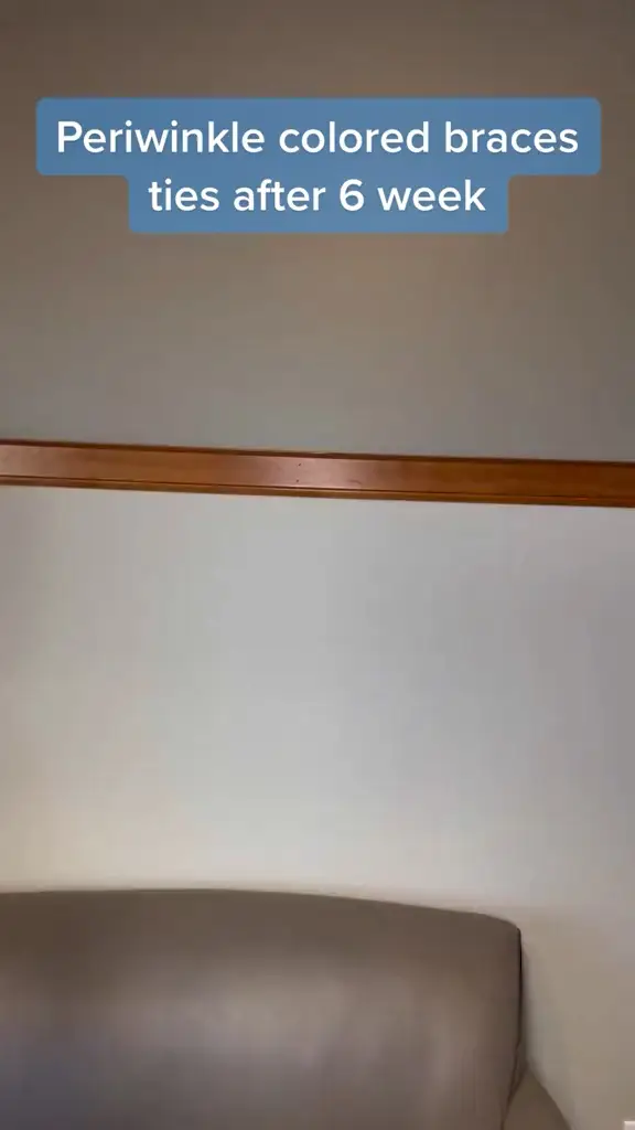 🥣Braces Colors: Periwinkle Edition 🥣 | Video published by Choice Ortho ...