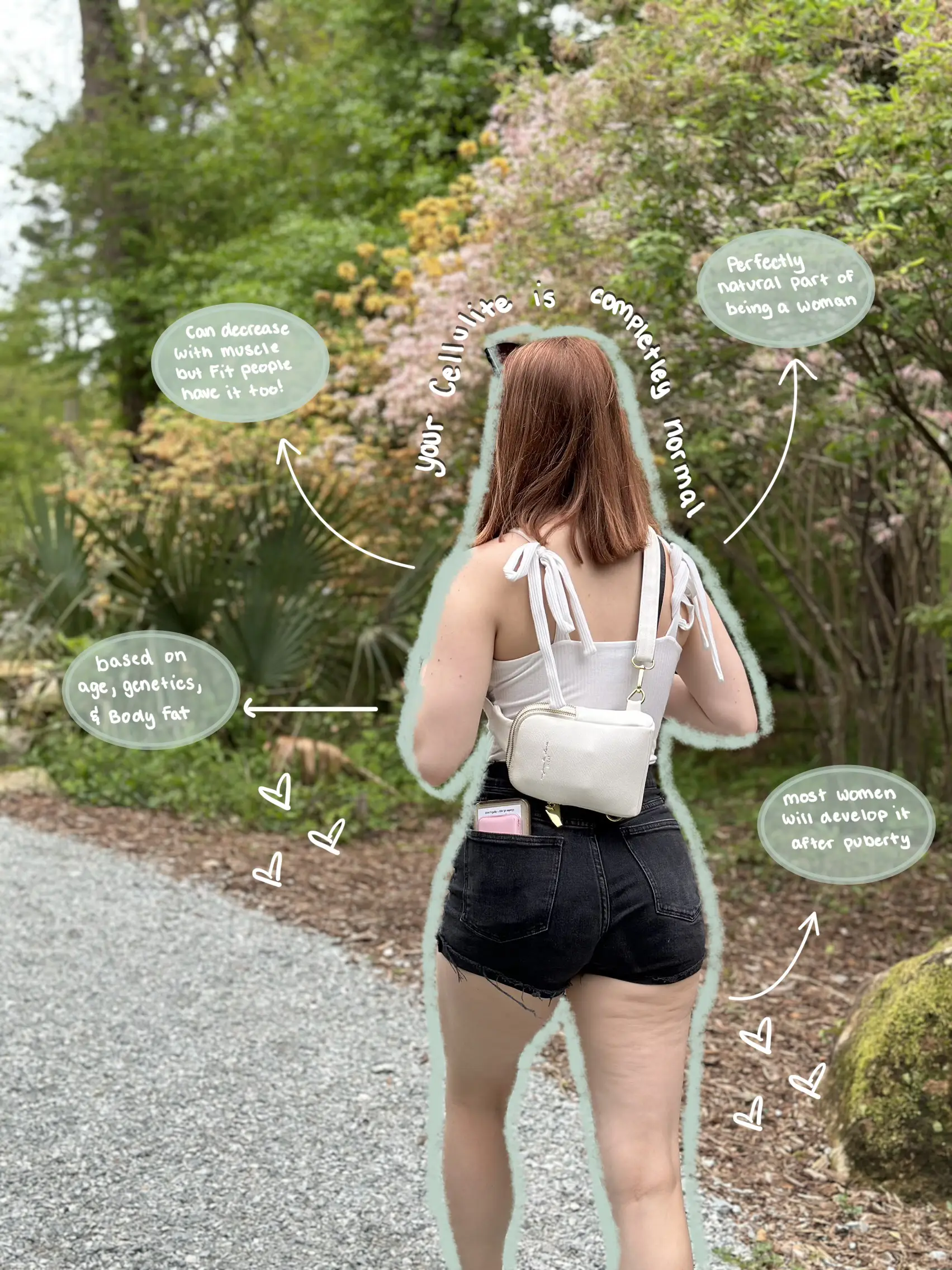 YOUR CELLULITE IS NORMAL! | Gallery posted by Bailey Stuart | Lemon8