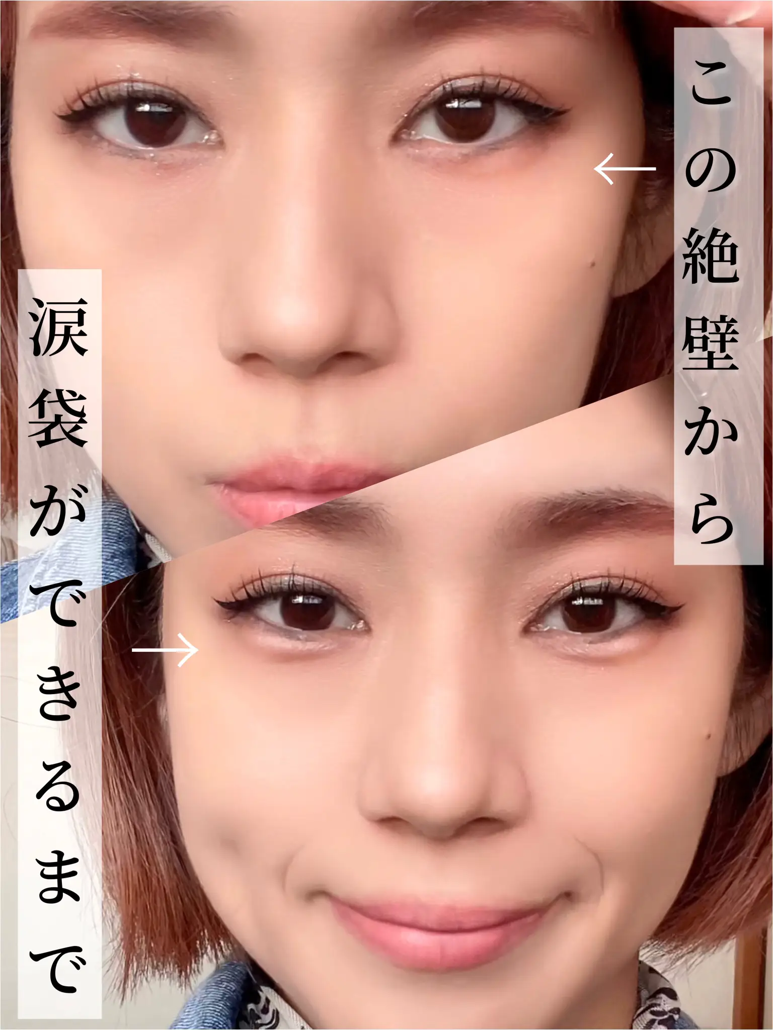 【ノーカット】絶壁から涙袋が誕生するドキュメント📹 | suiの投稿動画 | Lemon8