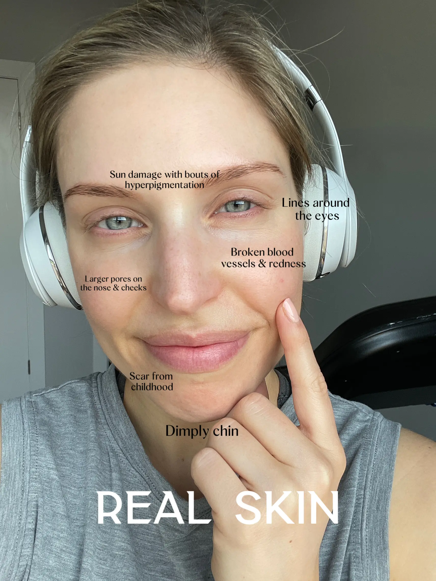 Real Skin | Gallery posted by Elizabeth | Lemon8