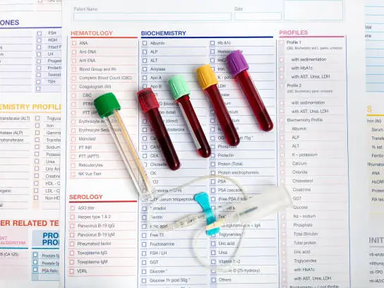 Need Blood work done,but are unsure, I can help | Gallery posted by ...