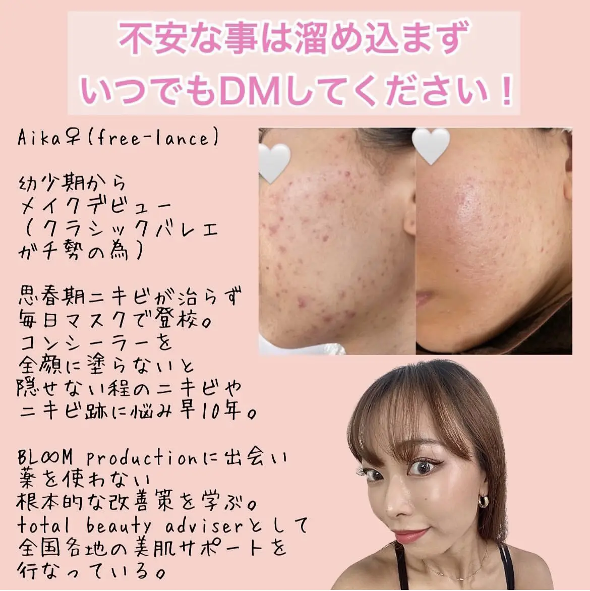 見直そう！〜スキンケア編〜 | Aika♡ズボラ美容で脱ニキビが投稿したフォトブック | Lemon8