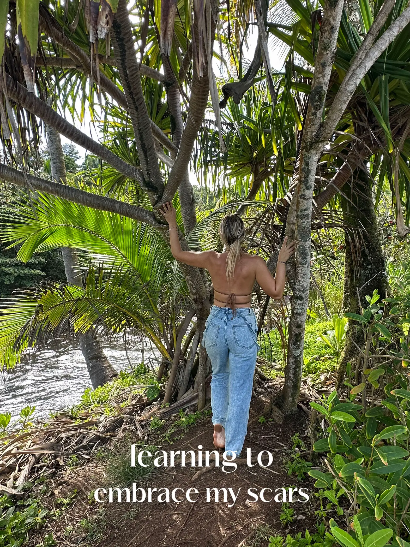 Embrace your scars | Gallery posted by Sienna | Lemon8