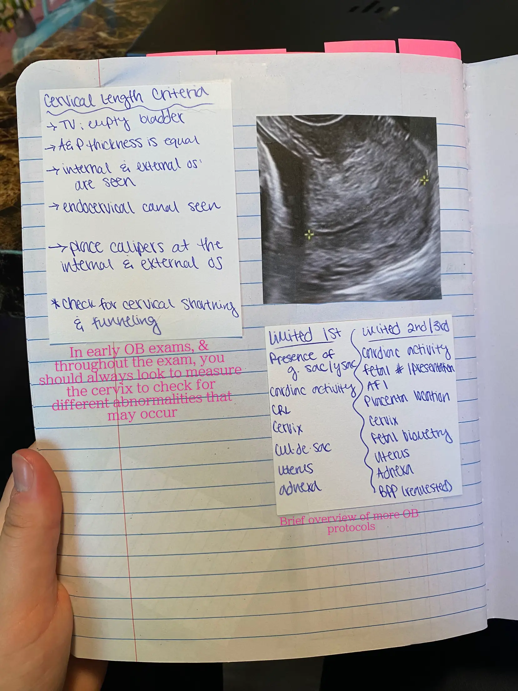 1st Trimester OB Exam | Gallery posted by Ky_SonoLife | Lemon8