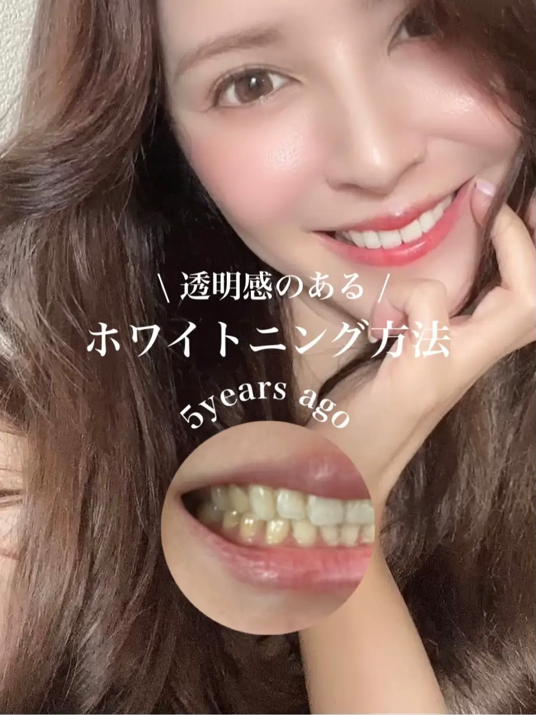 意外とみられてる！？ホワイトニング事情🦷 | shiho💍オイリー女美容の投稿動画 | Lemon8