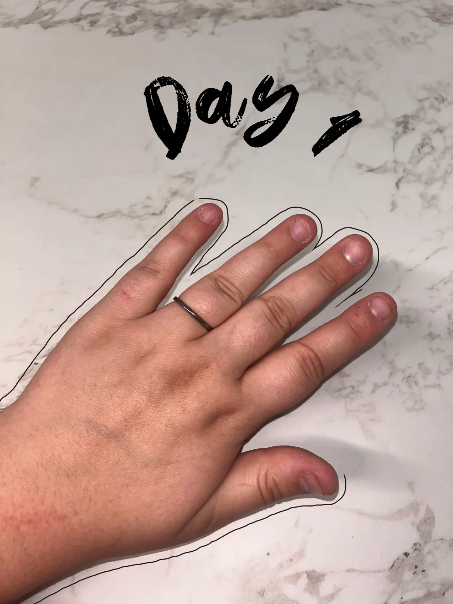 My nails are GROSS | Gallery posted by em | Lemon8