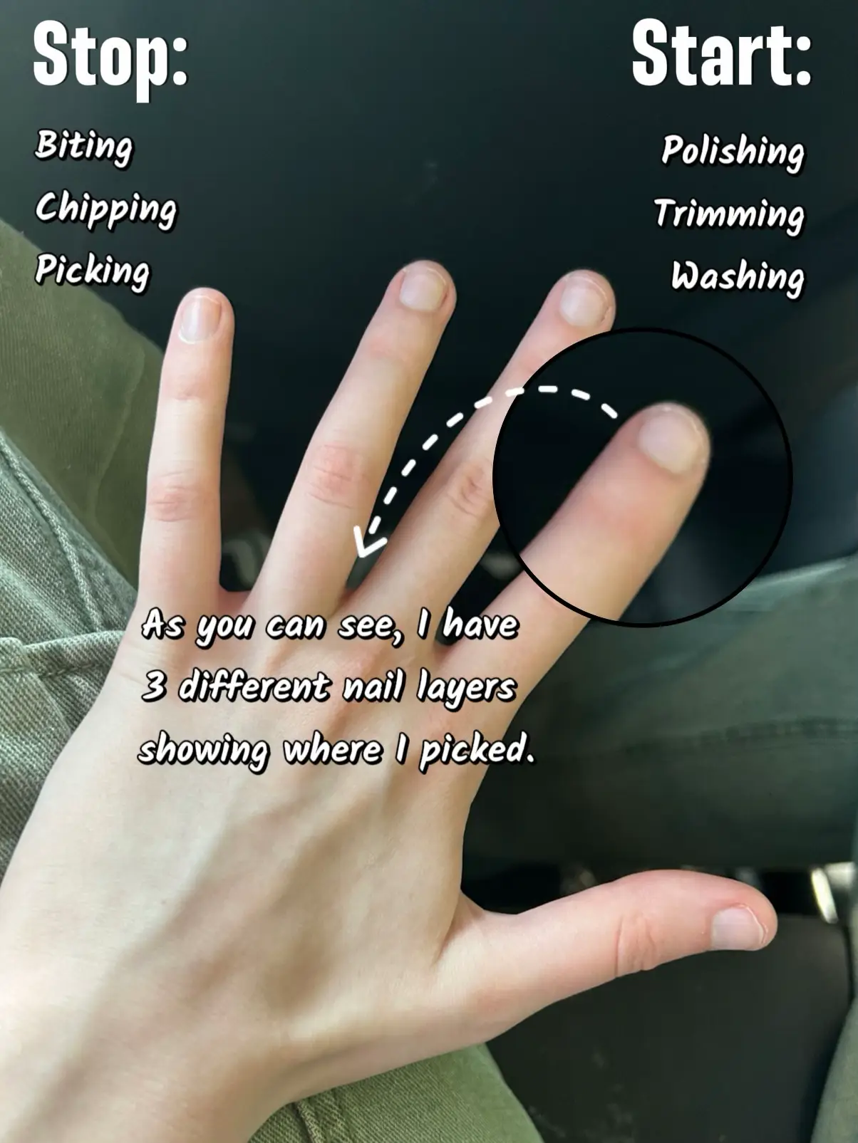 HOW I GREW MY NAILS IN TWO WEEKS | Gallery posted by Standard Cara | Lemon8