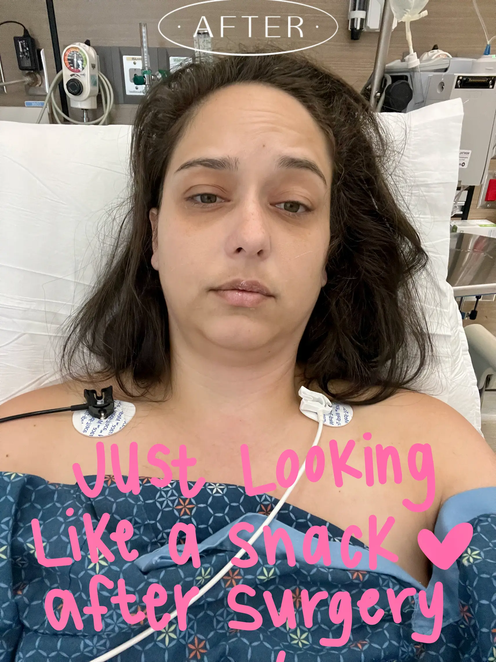 I GOT MY SURGERY AND I COULD CRY! 😭 | Gallery posted by Alyssa Andrade ...