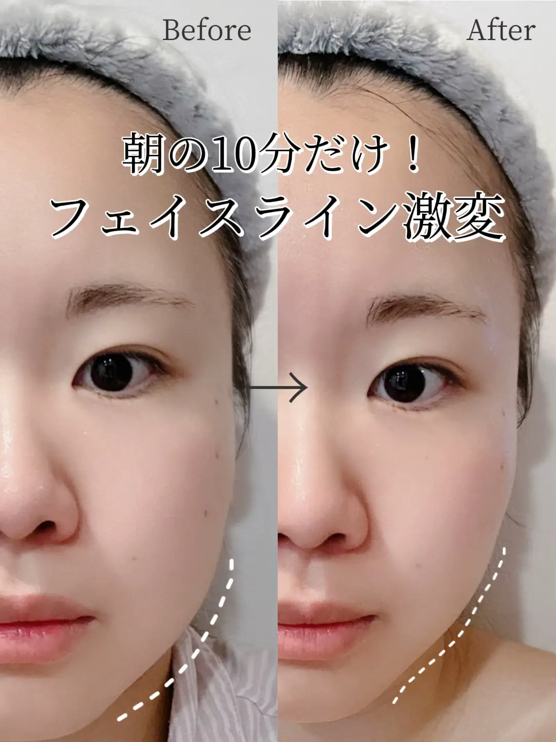 วิธีเปลี่ยนเส้นใบหน้า🤍ที่เล็กมาก🤣💕ฉันดูแลเกรดความงามที่บ้านทุกวัน💆🏻‍♀️ ...