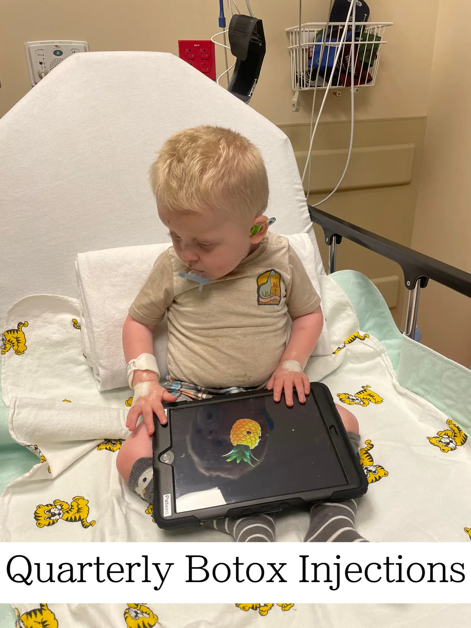 Quarterly Botox Injections | Gallery posted by Sarah Elizabeth | Lemon8