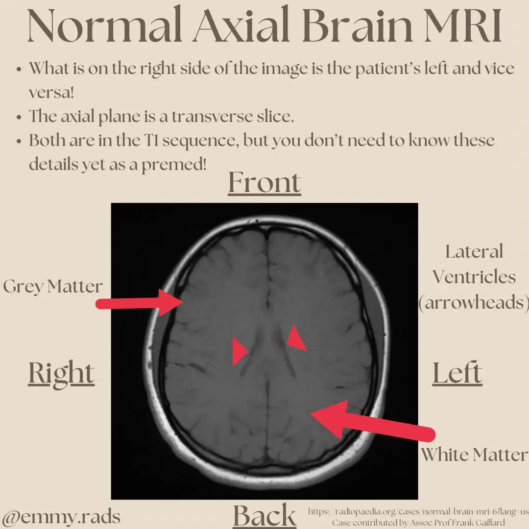 What is an MRI? | Gallery posted by Em Barnard, MD | Lemon8