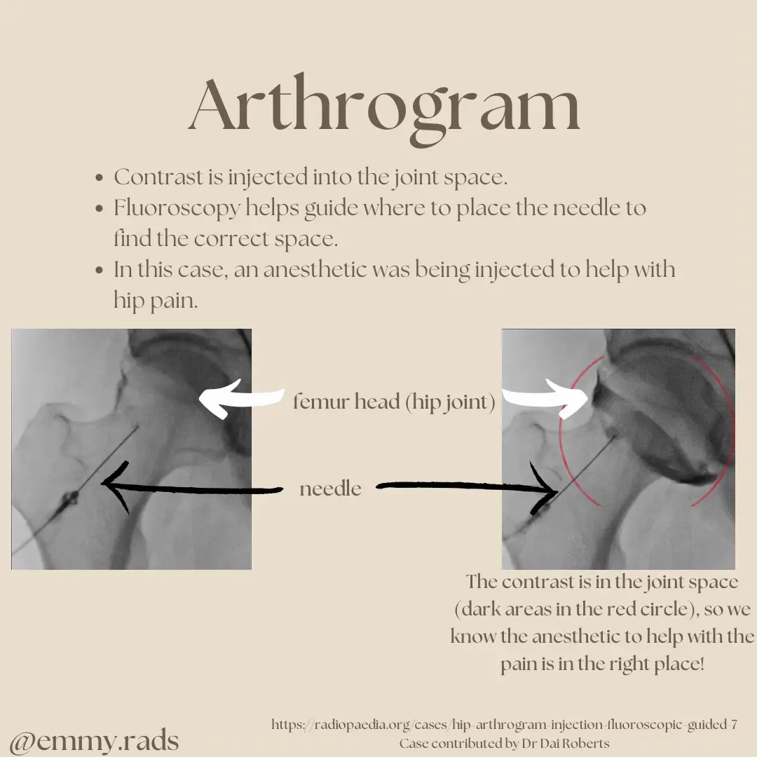 Fluoroscopy Explained | Gallery posted by Em Barnard, MD | Lemon8