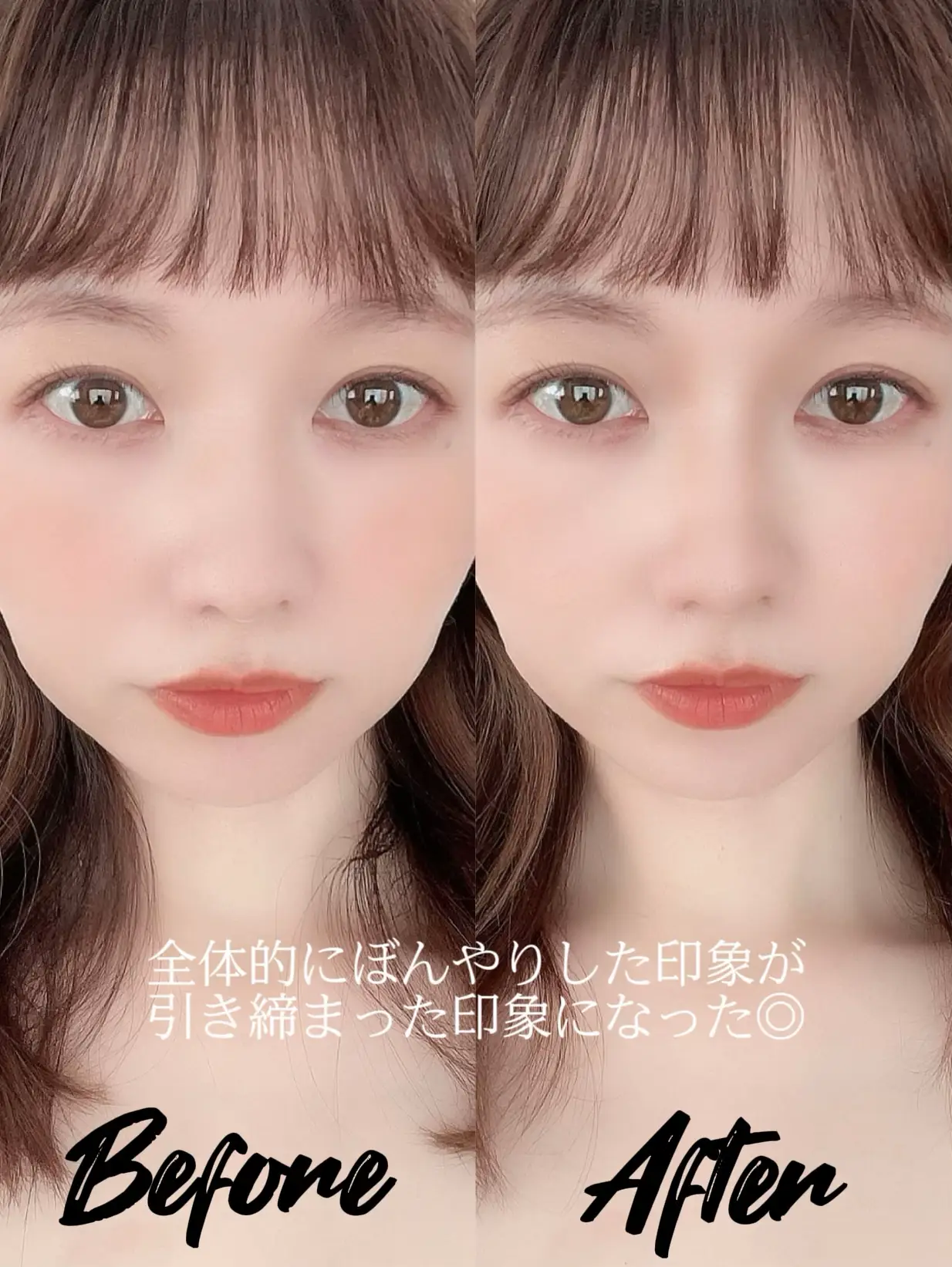 [Lemon8 face type diagnosis function] Worry solved! Nose reduction ...