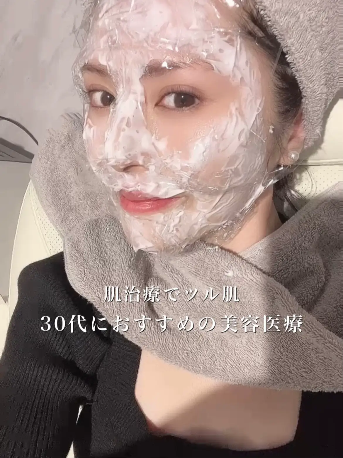 30代でやっておいてよかった肌治療 | shiho💍オイリー女美容の投稿動画 | Lemon8