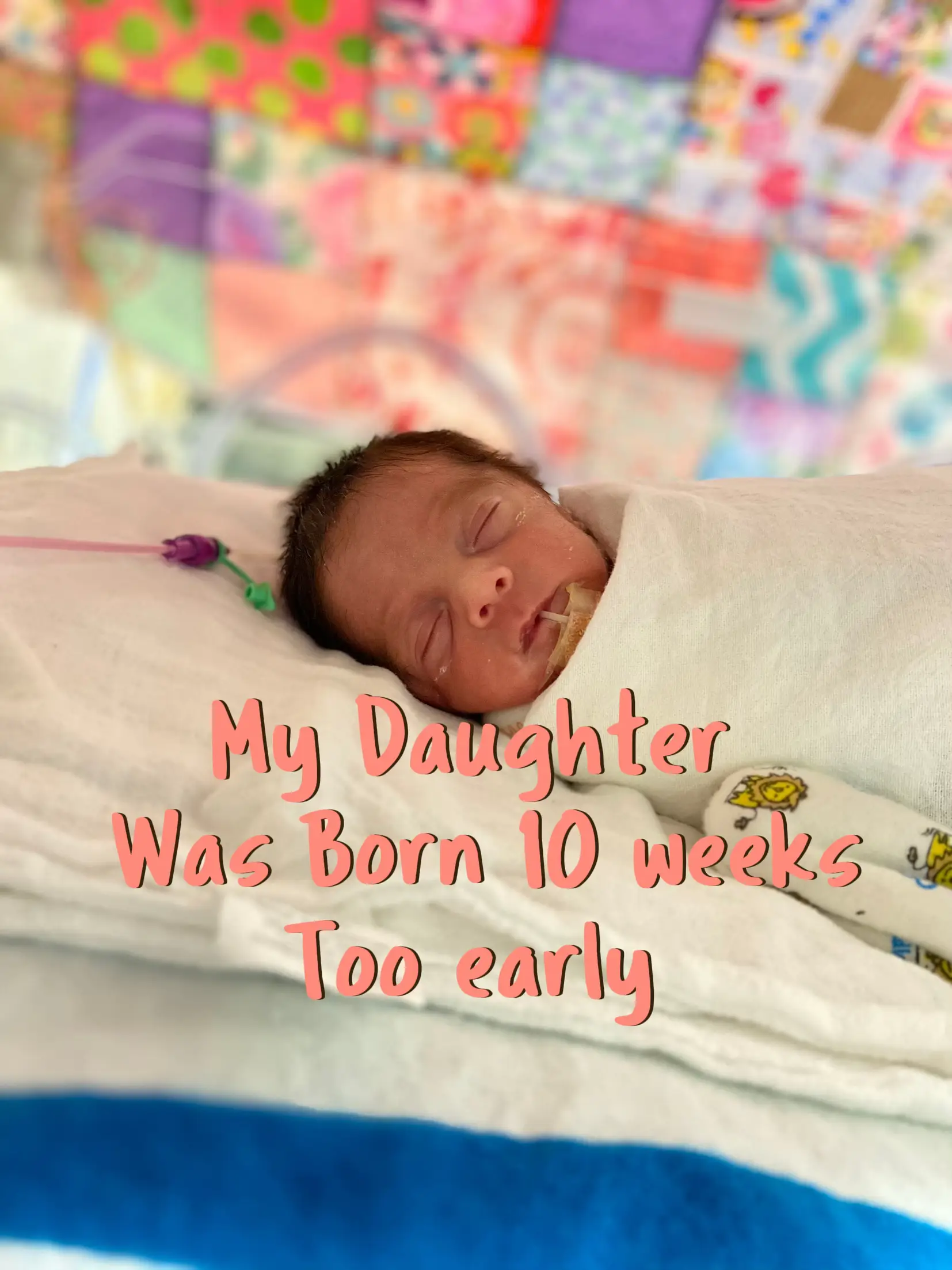 In 2022 my daughter was born at 30 weeks | Video published by SySy | Lemon8