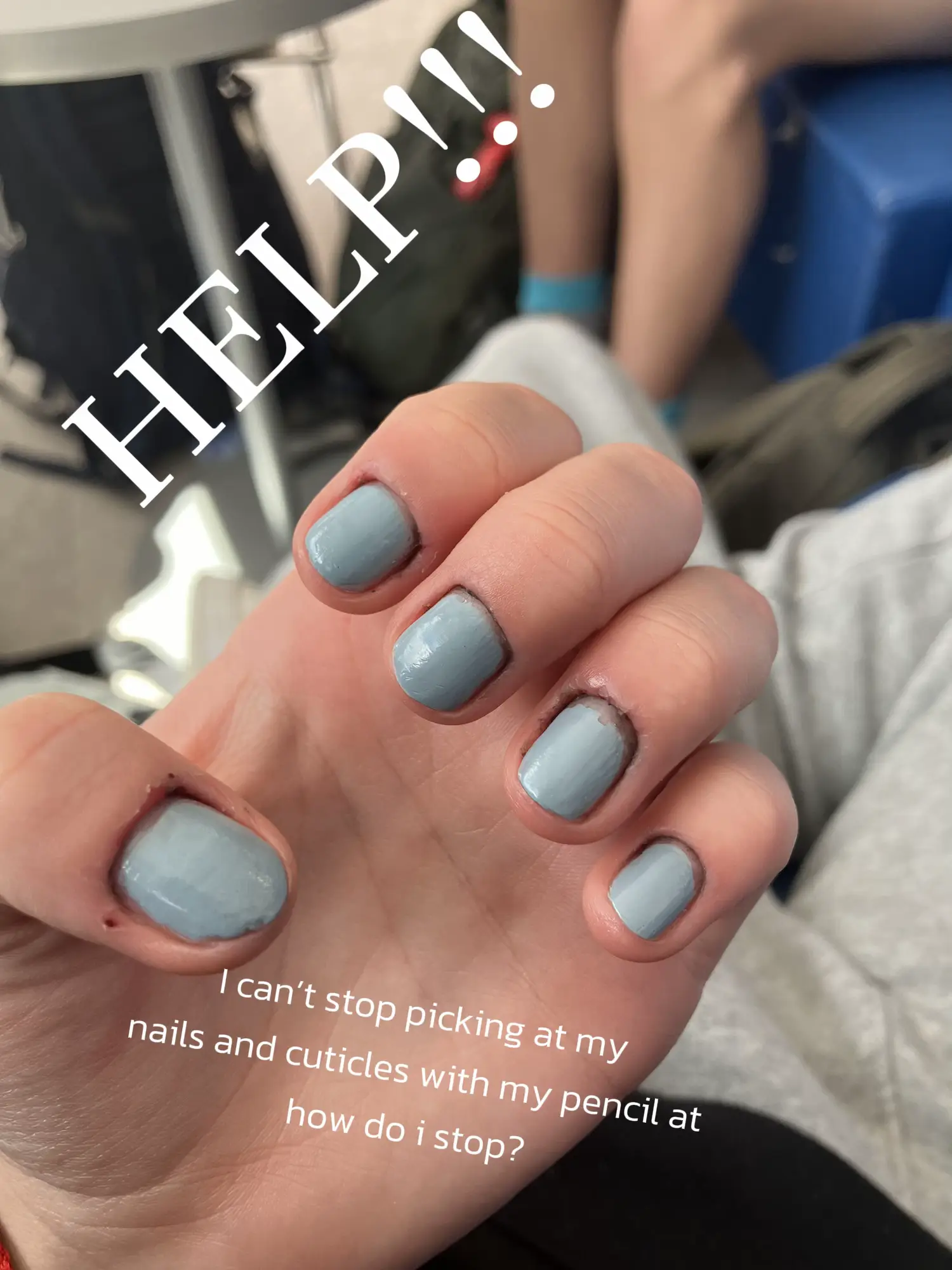 HELP!!! I can’t stop picking at me nails | Gallery posted by Olivia ...