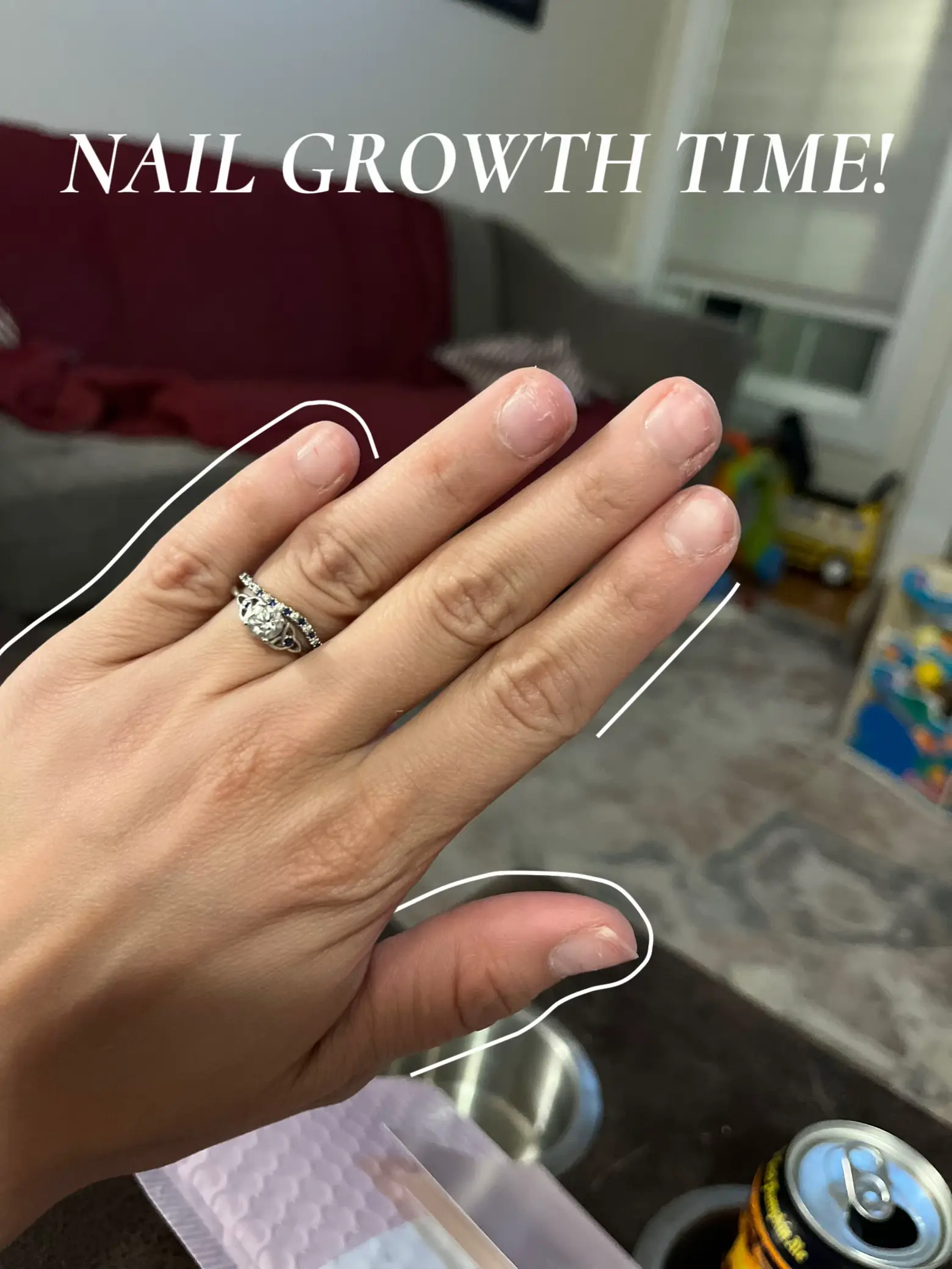 NAIL GROWTH TIME! | Gallery posted by Jess | Lemon8