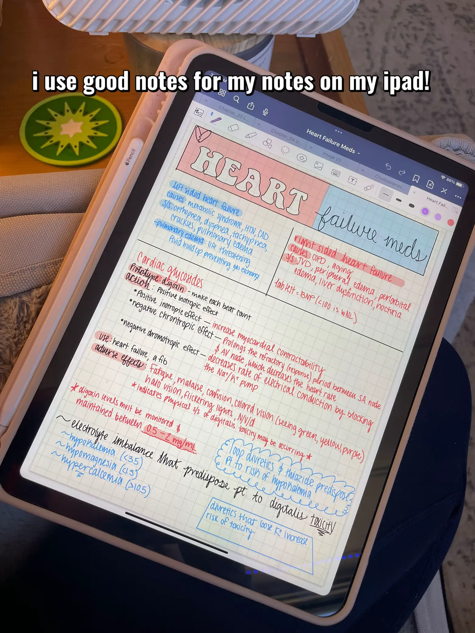 how i take notes in nursing school 🧠 | Gallery posted by hannah !! | Lemon8