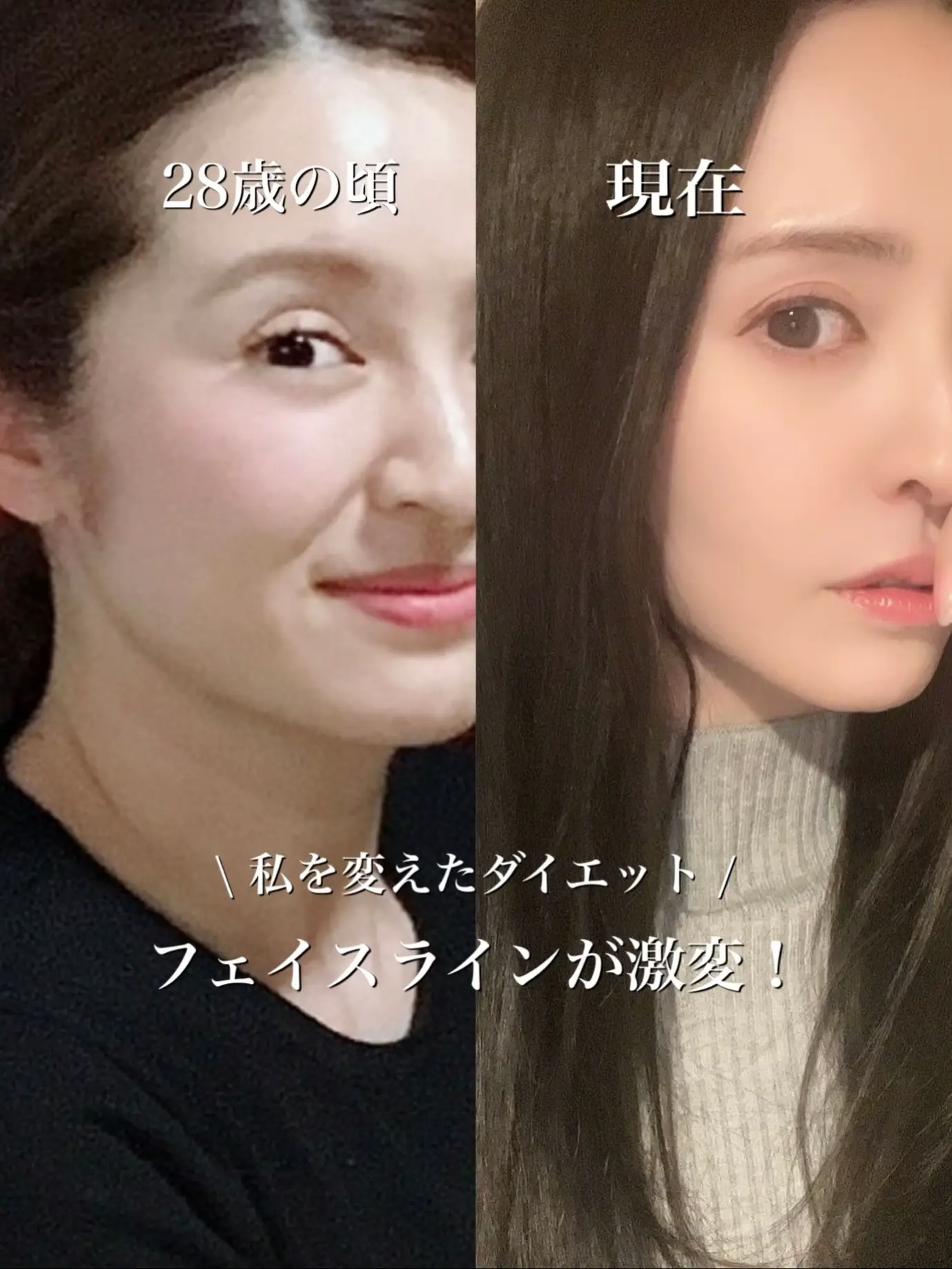 ダイエットとエラボトで激変🥹 | shiho💍オイリー女美容の投稿動画 | Lemon8