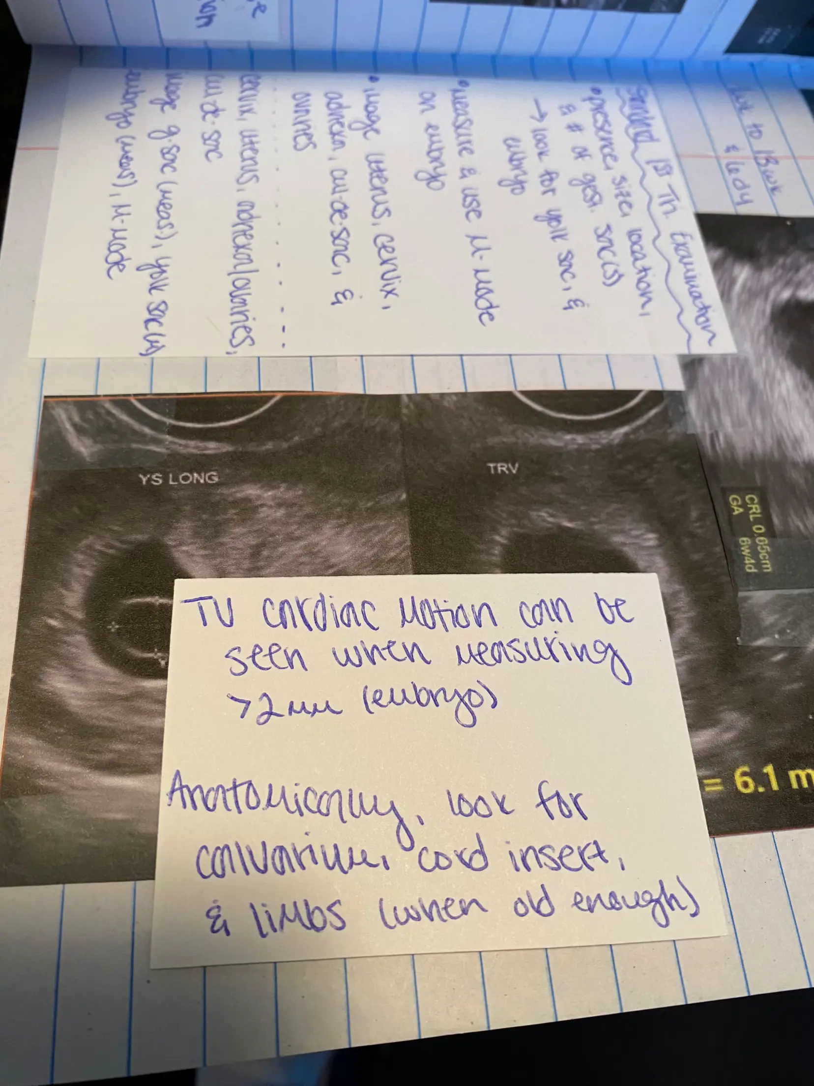 1st Trimester OB Exam | Gallery posted by Ky_SonoLife | Lemon8