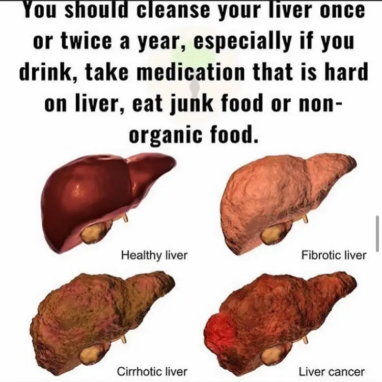 Liver Detox - Lemon8 Search