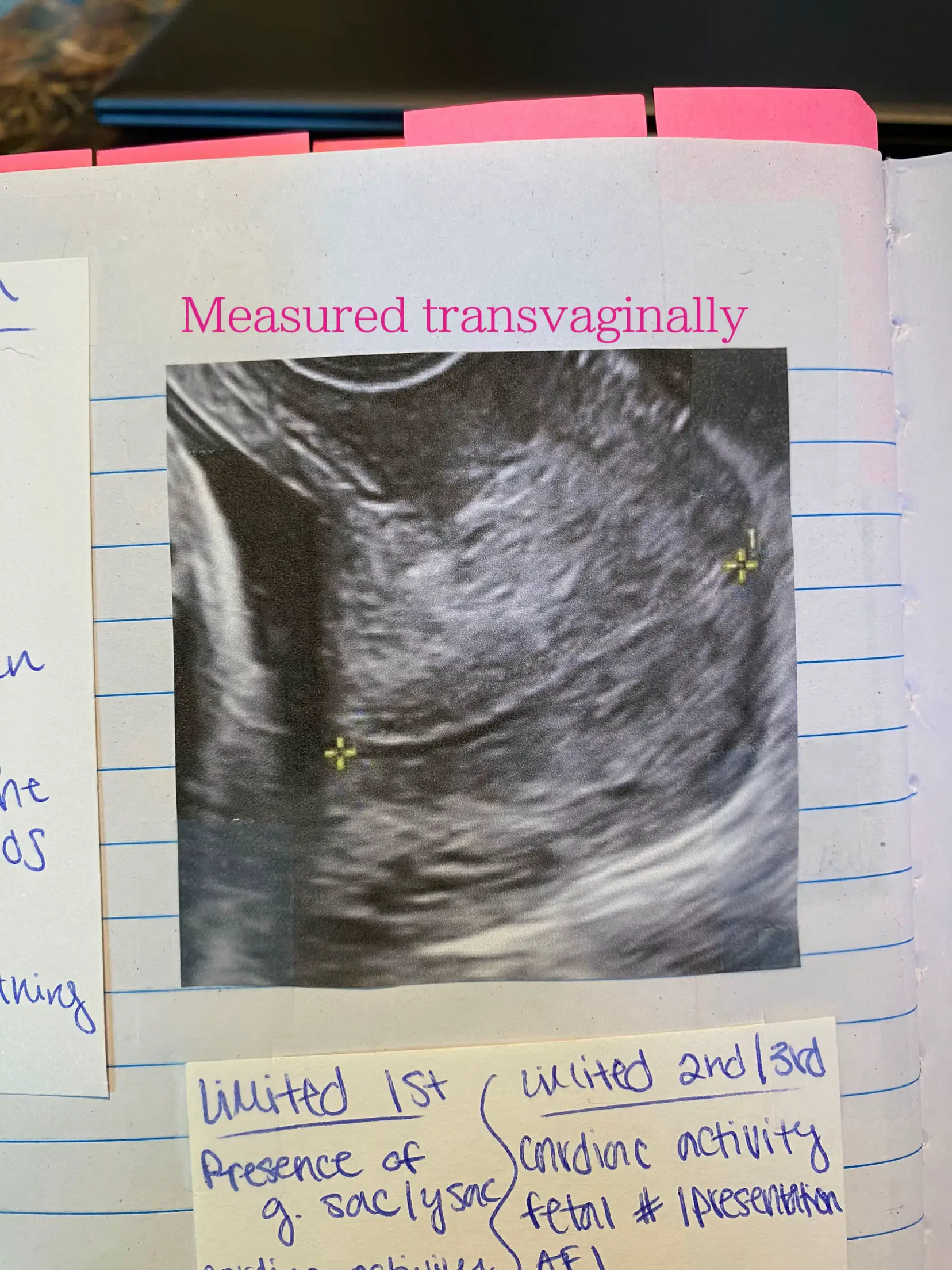 1st Trimester OB Exam | Gallery posted by Ky_SonoLife | Lemon8