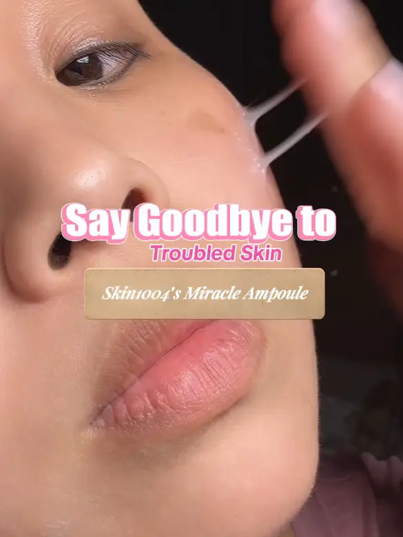 How Cica Soothes Redness and Inflammation | 2024 real user experience on Lemon8