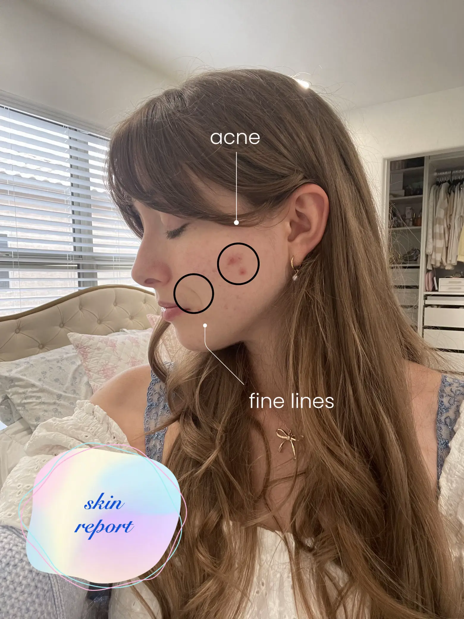 Skin Analyzer Test - Lemon8 Search