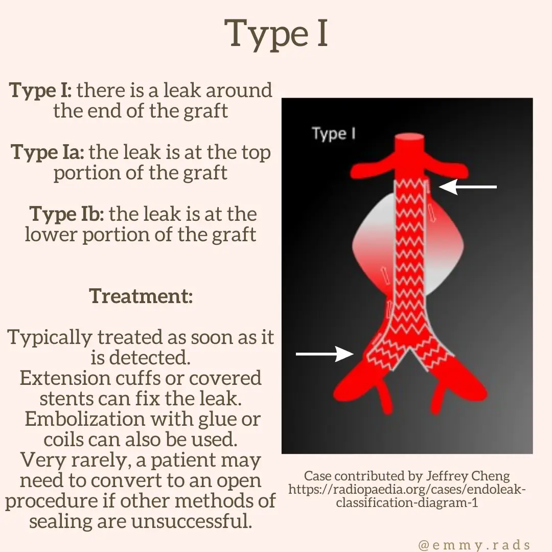 Endoleaks 🩸 | Gallery posted by Em Barnard, MD | Lemon8