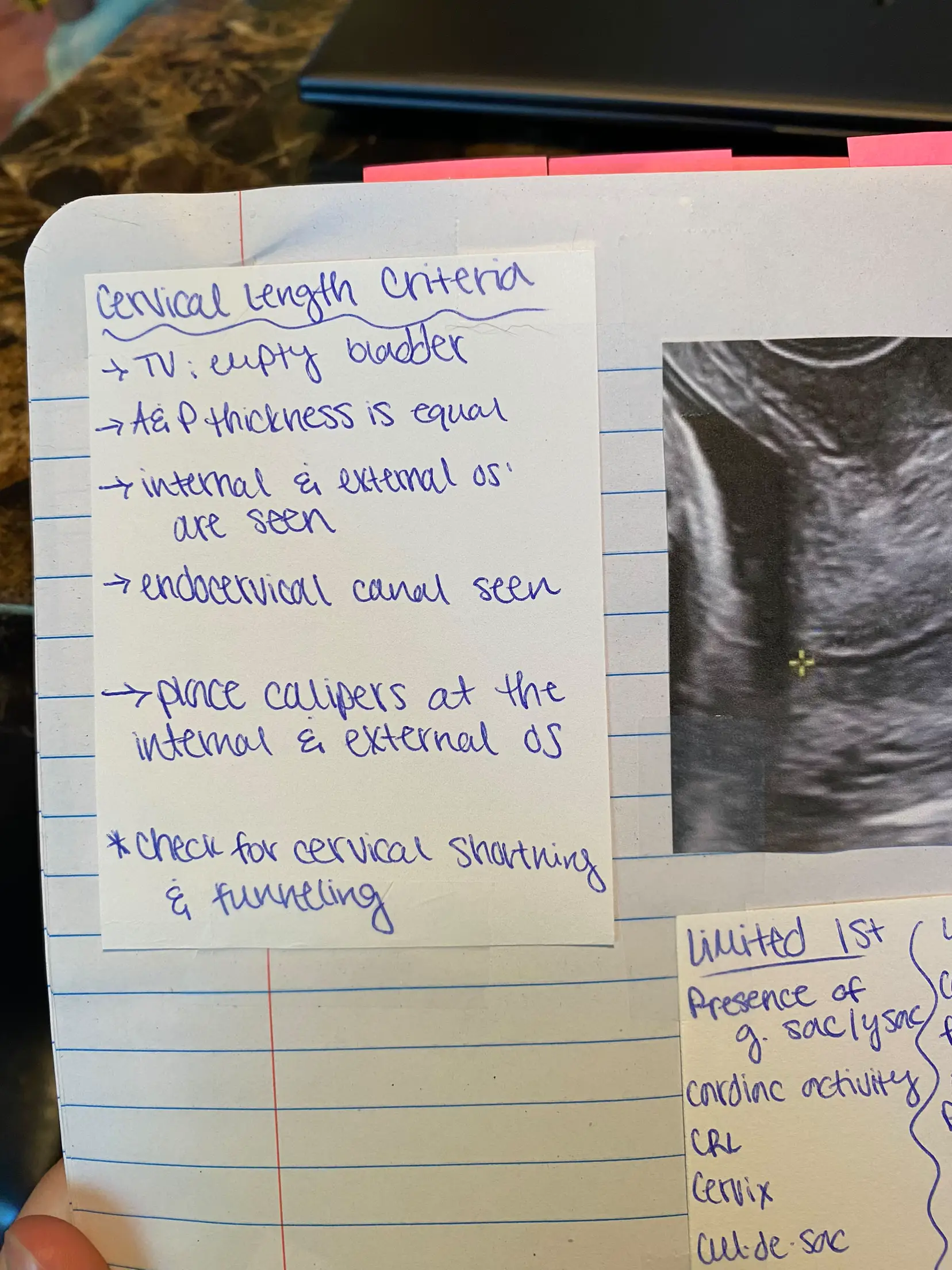 1st Trimester OB Exam | Gallery posted by Ky_SonoLife | Lemon8