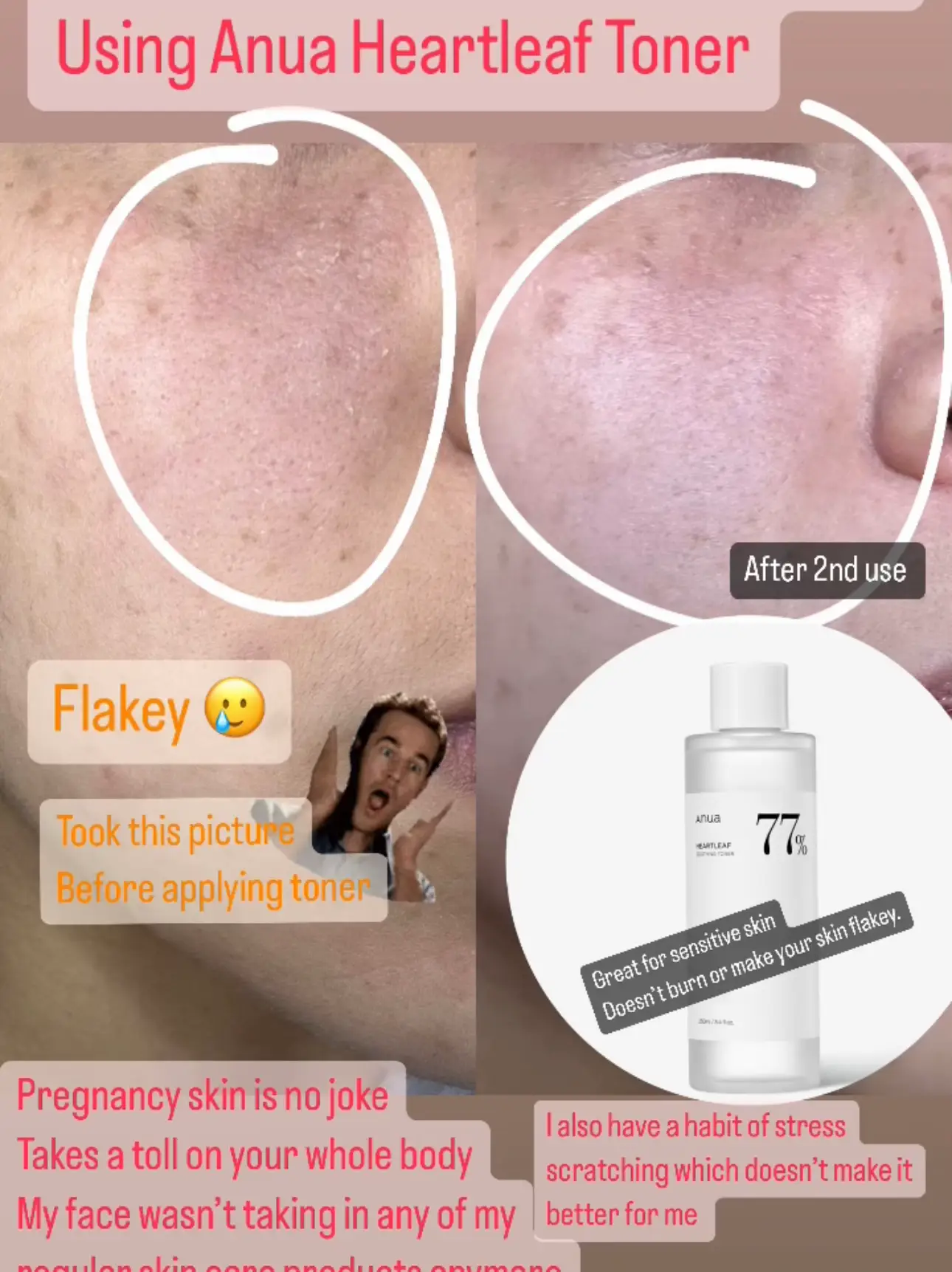 20 top Anua Heartleaf Toner Fake Vs Real ideas in 2024