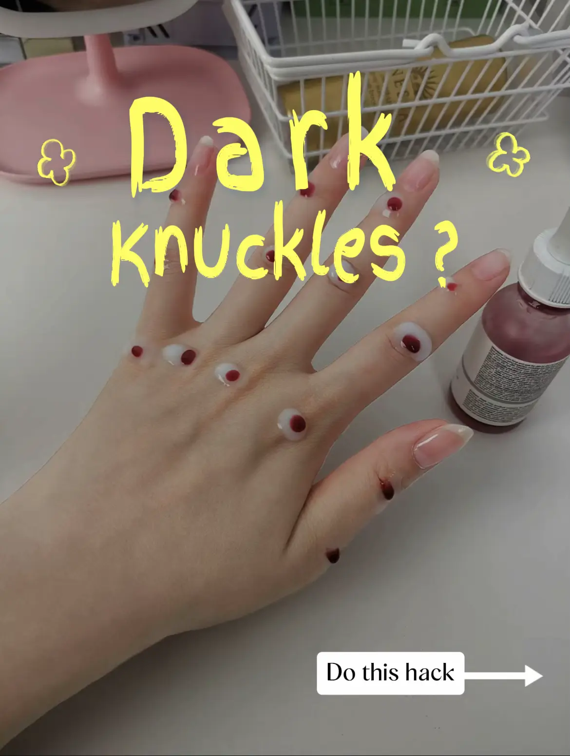 🎀How to get Rid of dark Knuckles🎀 | Gallery posted by Chérie blue | Lemon8