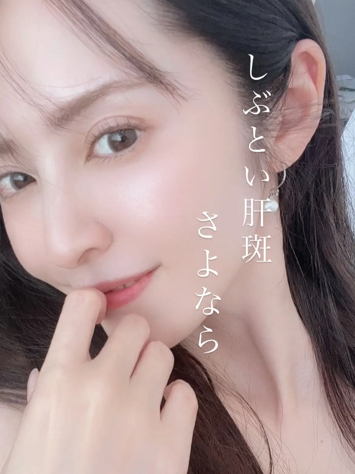 肝斑治療について | shiho💍オイリー女美容の投稿動画 | Lemon8