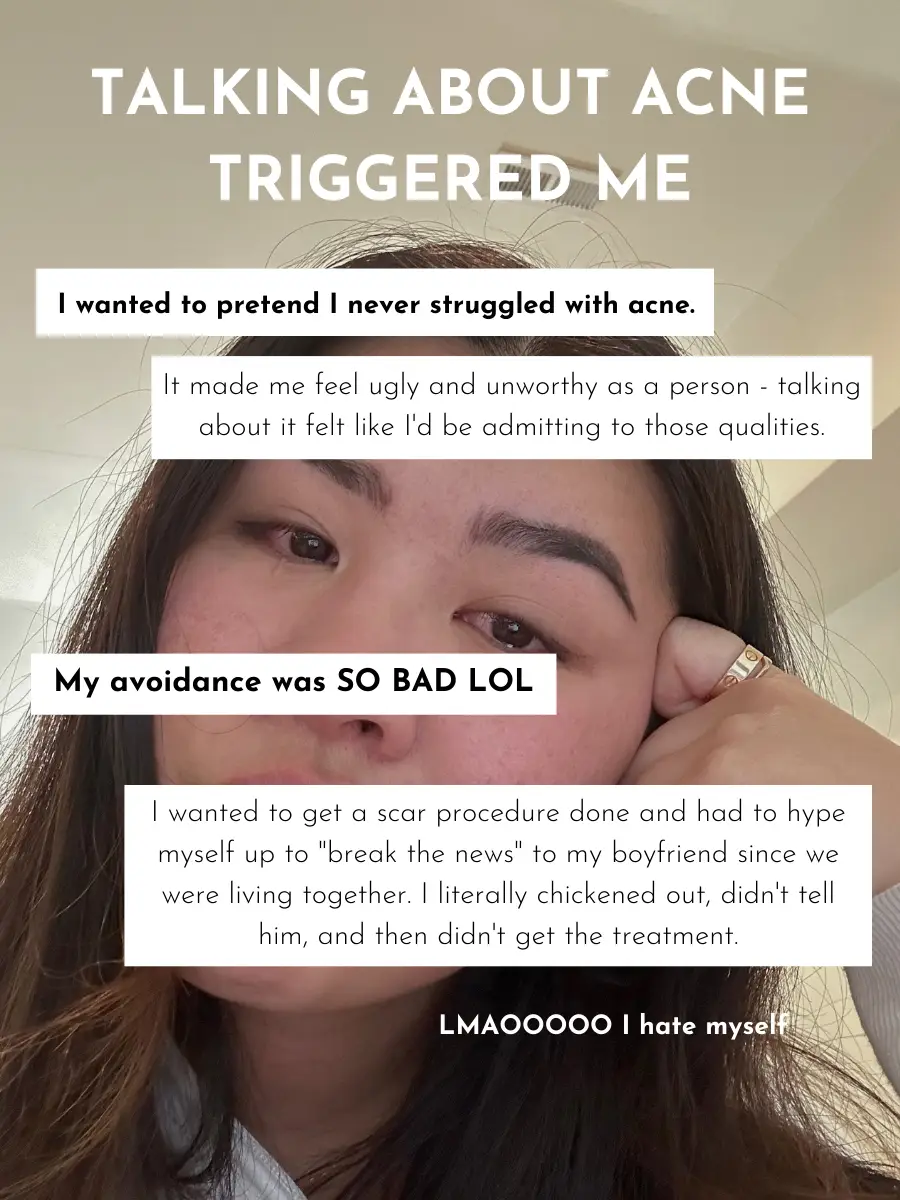 EXPOSING MY BIGGEST INSECURITY: acne & scarring🫠☹️ | Gallery posted by ...