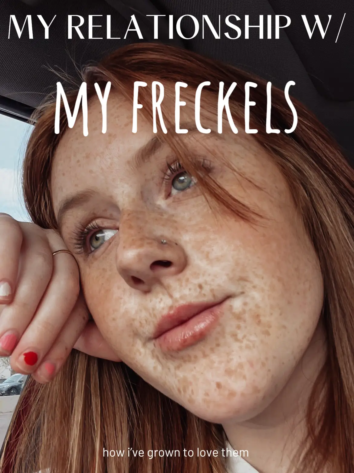 MY RELATIONSHIP W/ MY FRECKLES | Gallery posted by Katie_Stever | Lemon8