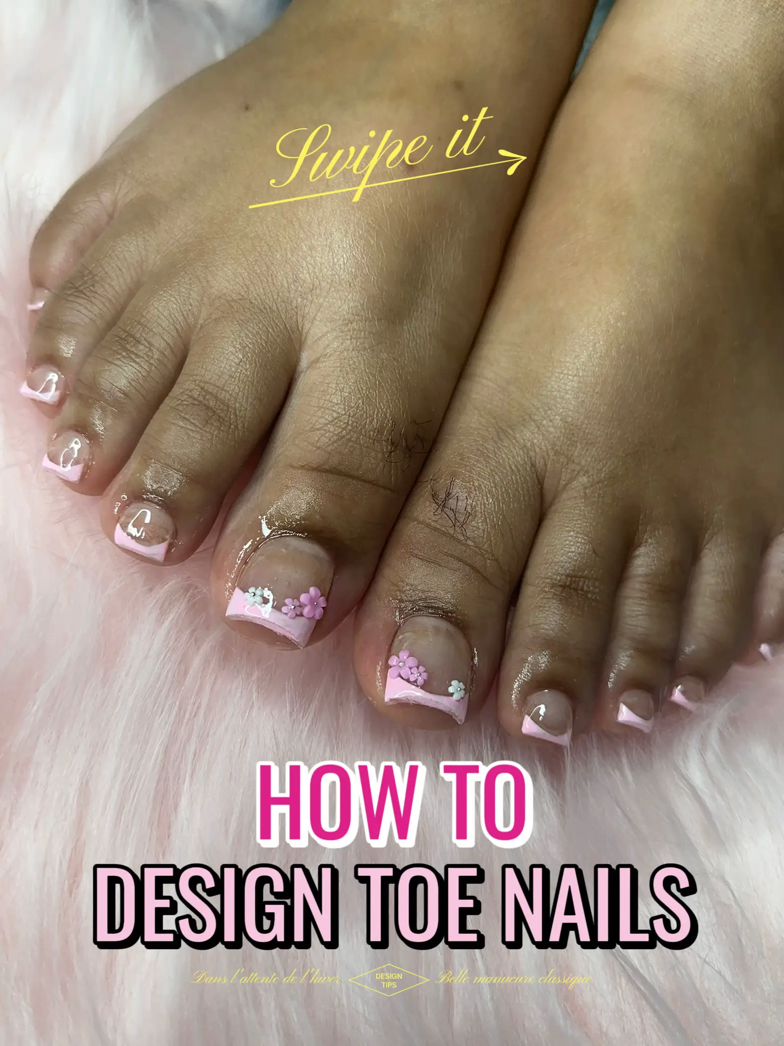 ACRYLIC OVERLAY SWIPE FOR MORE TOE DESIGN 💕 | Gallery posted by ...