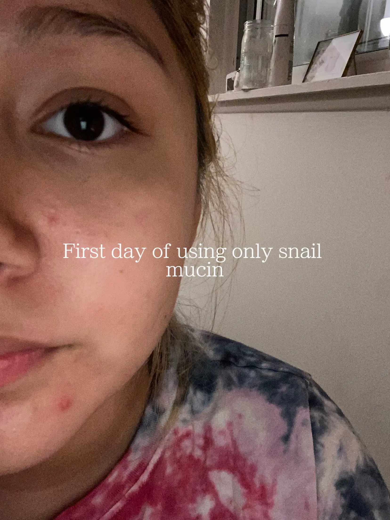 First dayversus one week of using only snail mucin | Gallery posted by ...