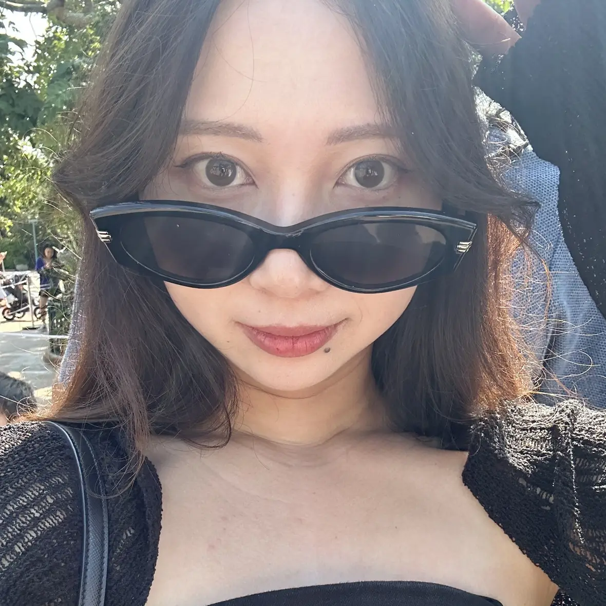 [レポ]小鼻ボトックスのBeforeAfter ️ | uriuが投稿したフォトブック | Lemon8